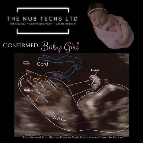 The Nub Techs Nub Theory Early Gender Prediction Artofit