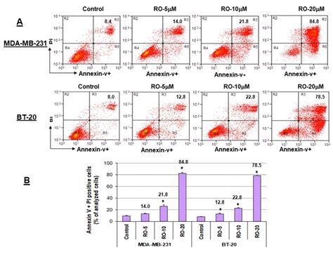 Cholesterol Biosynthesis Inhibitor Ro 48 8071 Suppresses Growth Of Tnbc