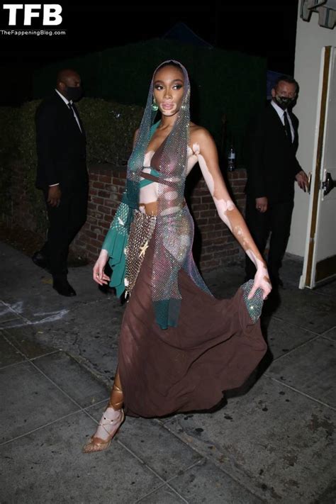 Winnie Harlow Winnieharlow Nude Onlyfans Photo 71 The Fappening Plus