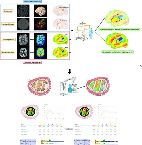 A Data Processing Flow Chart For Preoperative Evaluation B Data Download Scientific