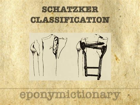 Schatzker Classification System Archives • Litfl