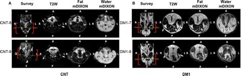 Dm1 Model Mice Show Partial Pathological Phenotypes Representative Download Scientific Diagram