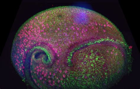 Overview Of Microscopy Techniques Confocal Widefield Transmitted