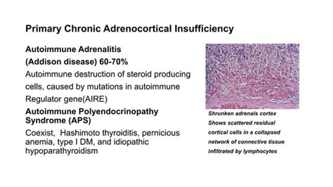 Adrenal Cortical Disorderspptx Ppt