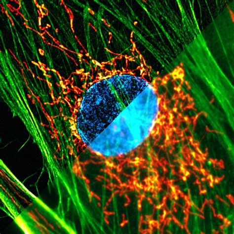Embl Master Course Bioimage Data Analysis Bias 2014 12 16 May