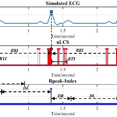 R Peak Detection Principles Simulated The Algorithm Is Summarized In Download Scientific