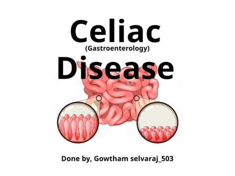 Celiac Diseasegastroenterology Gowtham503 1pptx