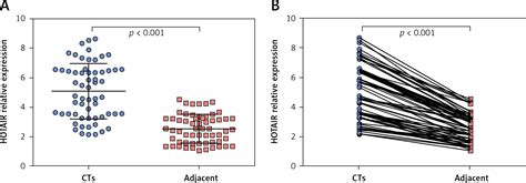 The Expression Of Long Non Coding Rna Hotair In Advanced Hepatocellular