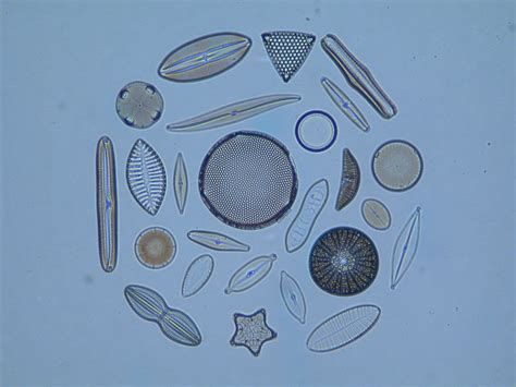 Klaus Kemp In Memoriam Cleaned Diatom Samples For Microscopy