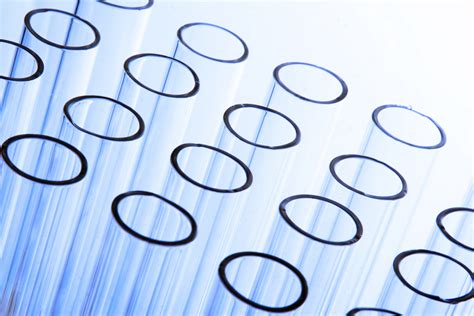 Prostate Cancer Genetic Test Can Identify Aggressive Cancer Time