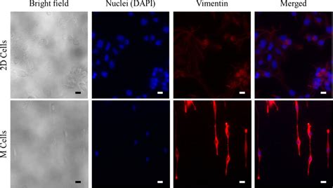 Increased Vimentin Expression In Migrating Cells Representative Images Download Scientific