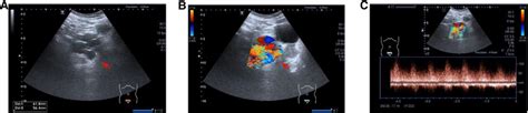 A Multiple Tortuous Tubular Structures Within An Irregularly Shaped