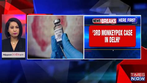 Monkeypox Delhi Nigerian Man Tests Positive For Monkeypox Tally