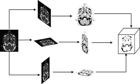 Basic Flow Of Mpr A The Reconstruction Diagram Of The Algorithm And