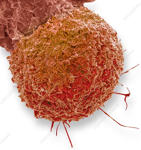 Respiratory Syncytial Virus Sem Stock Image C0586424 Science