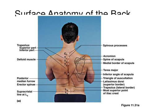 Iliac Tubercle Surface Anatomy