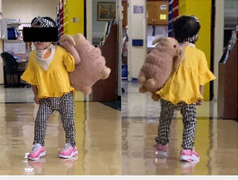 Clinical Picture Of The Patient At Two Year Follow Up Download Scientific Diagram