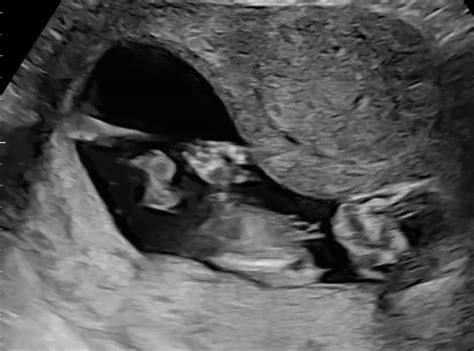 Dear Caleyah Life Has A Way Of Surprising Us In The Most Beautiful Ways … Christopher Pham