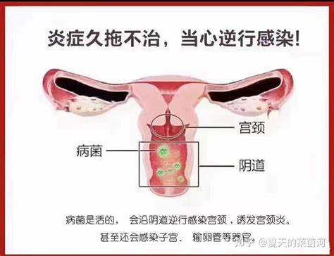 惠民 外阴瘙痒怎么办 知乎