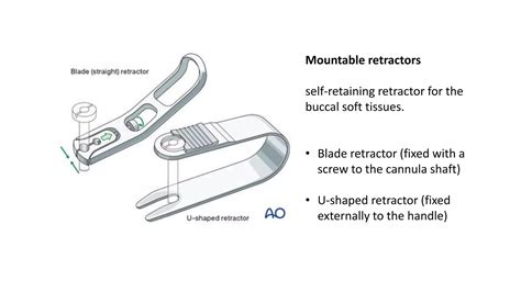 Management Of Mandibular Angle Fracture Pptx