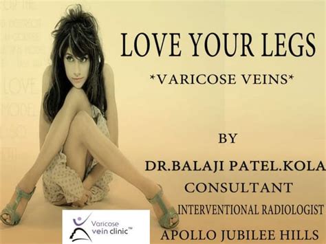 Varicose Veins Treatment In Hyderabad Veindoctor Clinic Ppt