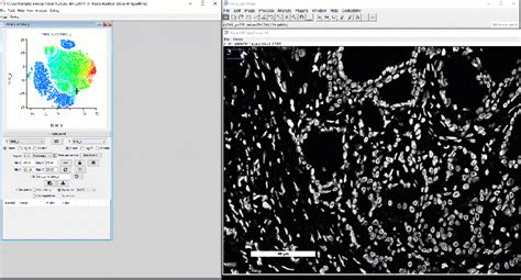 Codex Software Suite Unlocks The Power Of Single Cell Spatial Analysis In Ffpe Tissue Akoya