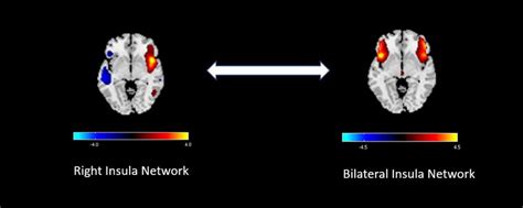 the fmri brain images see bidirectional arrow depicting a component