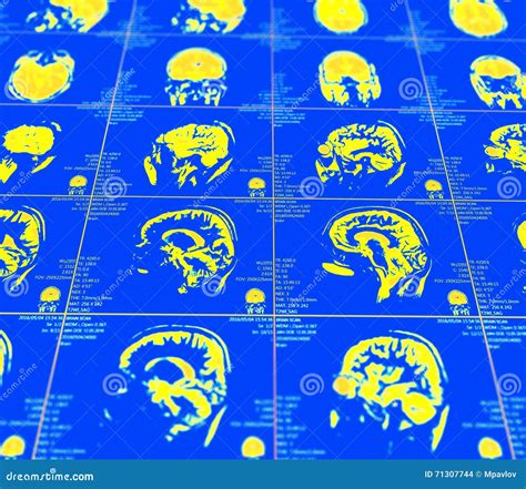Magnetic Resonance Imaging Concept In Isometric Vector Design Male