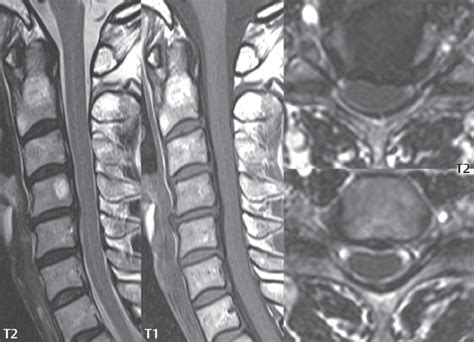 Congenital Disease Radiology Key