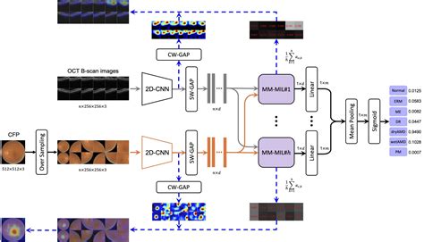 Mm2021 Multi Modal Multi Instance Learning For Retinal Disease