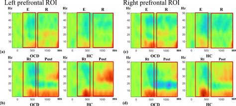 Event Related Spectral Perturbation Ersp Map During The Delayed Download Scientific Diagram