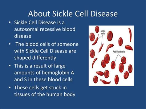 Ppt Sickle Cell Disease Powerpoint Presentation Free Download Id