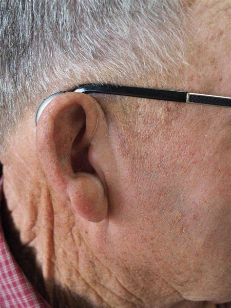 Como Minimizar Os Efeitos Da Perda Auditiva