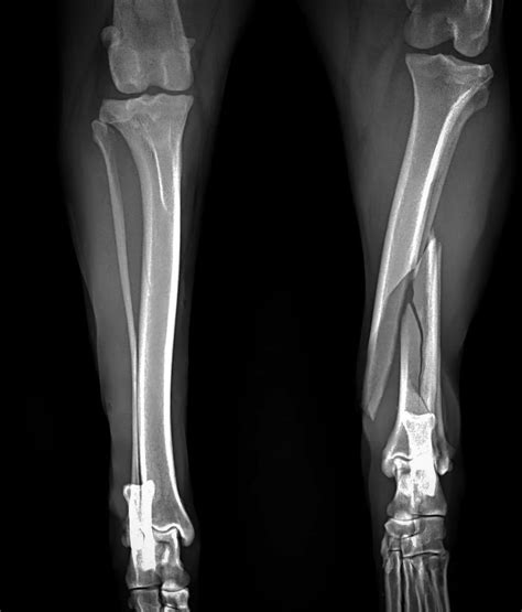 Fractura Conminuta De Tibia En Un Veterinaria Olmos