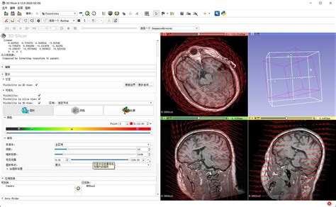 3d Slicer磁共振图像位置坐标如何旋转图像 问题求助 3dslicer中文论坛