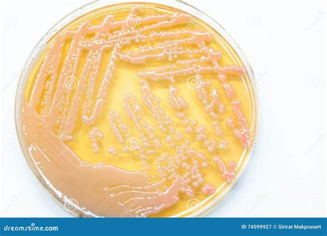 Bacterial Culture Growth On Macconkey Agar Gram Negative Bacilli