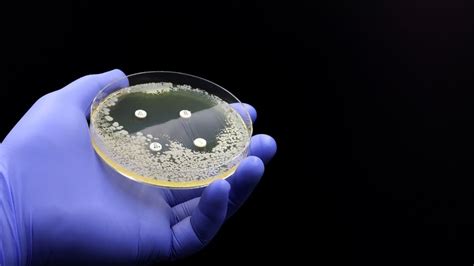 Bacterial Transformation And Transformation Protocol Technology Networks