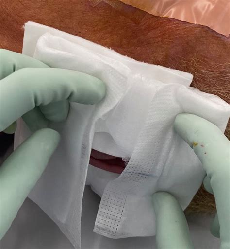 Post Auricular Dressings Dr Sean Flanagan