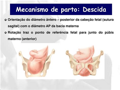 Ppt Assistência Ao Parto Powerpoint Presentation Free Download Id