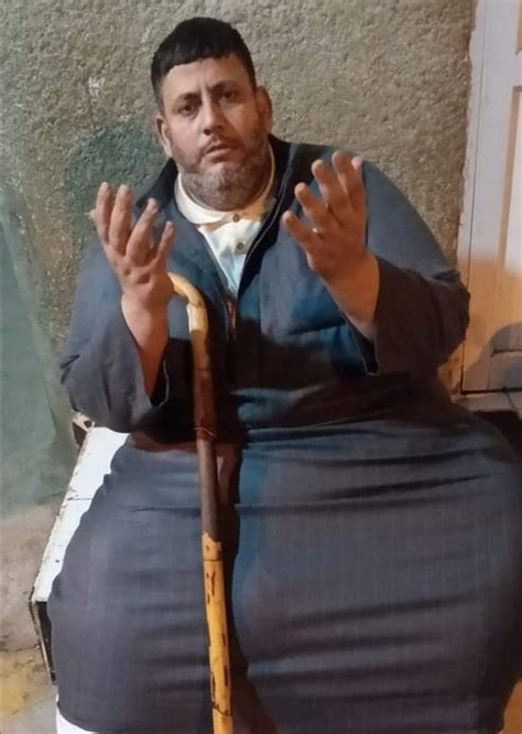وزنه 350 كجم وفاة شاب يعاني من مرض داء الفيل