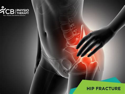 Top 5 Exercises For Hip Fracture Png