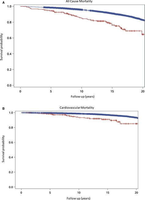 Mortality In Patients With Right BundleBranch Block In The Absence Of