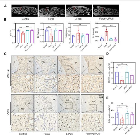 Figure 2 From Low Intensity Pulsed Ultrasound Promotes The Osteogenesis