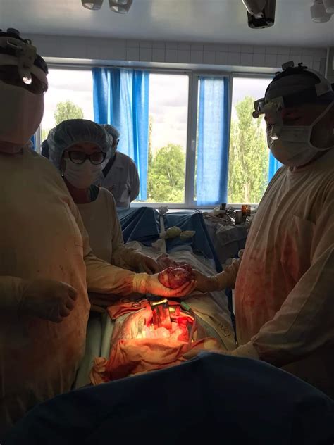 У Миколаєві лікарі провели дитині унікальну операцію з видалення злоякісного новоутворення