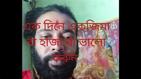 এক দিনে একজিমা বা হাজা ঘা ভালো করুনtantra Yoga Foundation Youtube