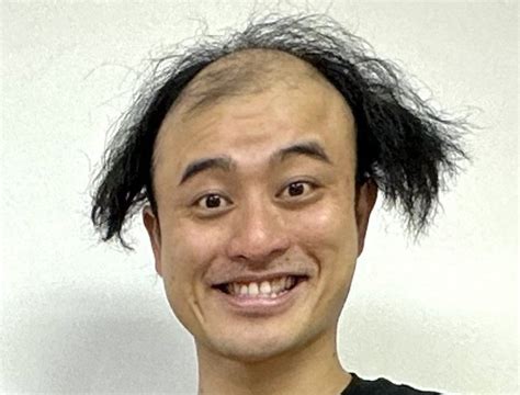 福岡のお笑い芸人が英人気オーディション番組で快挙 「ゴールデンブザー」獲得し準決勝進出「人生最大の笑い！ハゲみになります！」：「おっ！」で