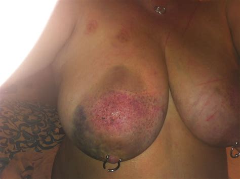 Scottish Slut Worst Beating Yet Porn Pictures Xxx Photos Sex Images