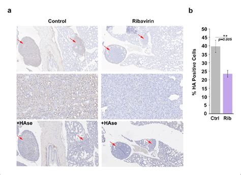 Ha Biosynthesis Is Required For Eif4e Mediated Lung Metastasis In Mice