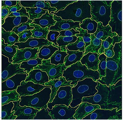 Digital Image Analysis For Scientific Applications Scilifelab