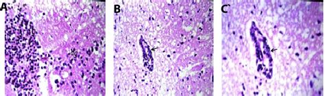 A Brain Of Mice In Group 2 Showing Focal Fg As Well As Diffuse Dg
